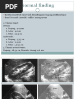 Anatomi Thorax Normal + Gambaran Radiologi | PDF