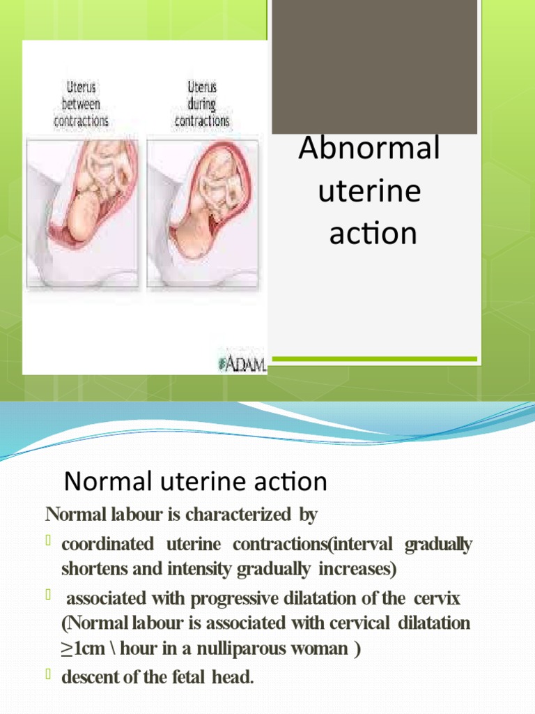 Understanding Abnormal Uterine Action | PDF | Childbirth | Uterus