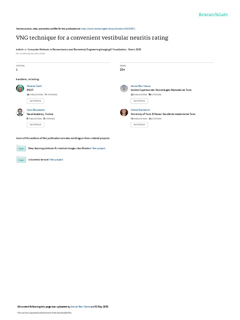 VNG Technique For A Convenient Vestibular Neuritis Rating | PDF ...