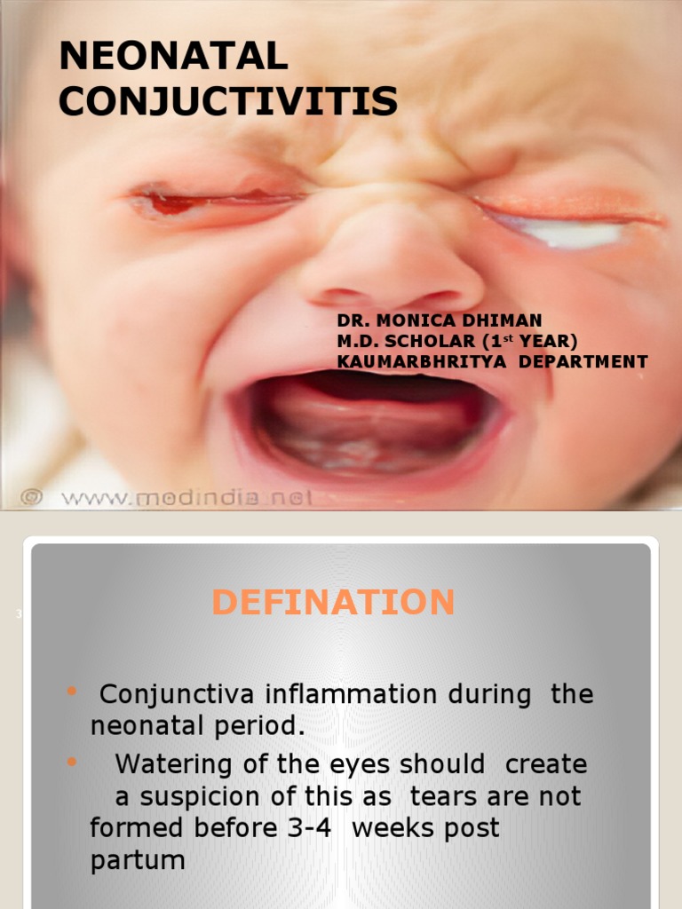 (Neonatal Conjunctivitis) Dr. Monica Dhiman | PDF | Microbiology ...