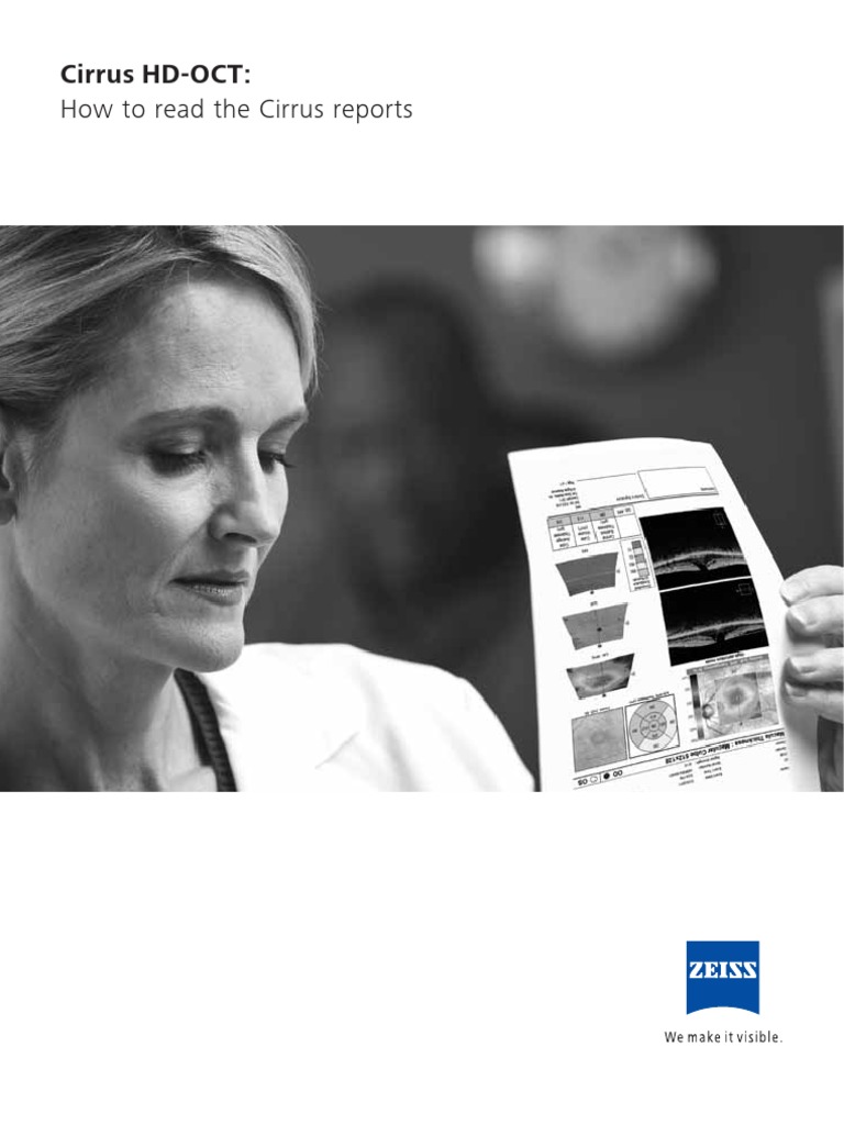 How To Read Cirrus Reports-2 | PDF | Retina | Ophthalmology