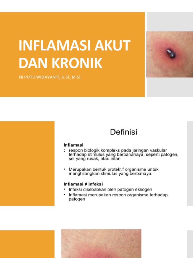 Inflamasi Akut Dan Kronik | PDF