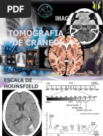 Niveles Axilares de Berg | PDF | Finanzas y dinero