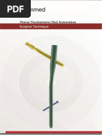 7118-1131 Trigen InterTAN | PDF | Hip | Screw