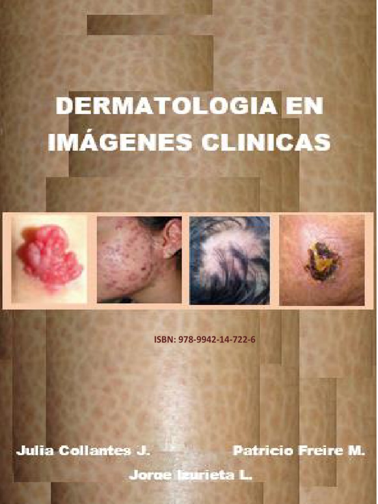 Dermatologia Imágenes Clinicas | PDF | Epidermis | Piel