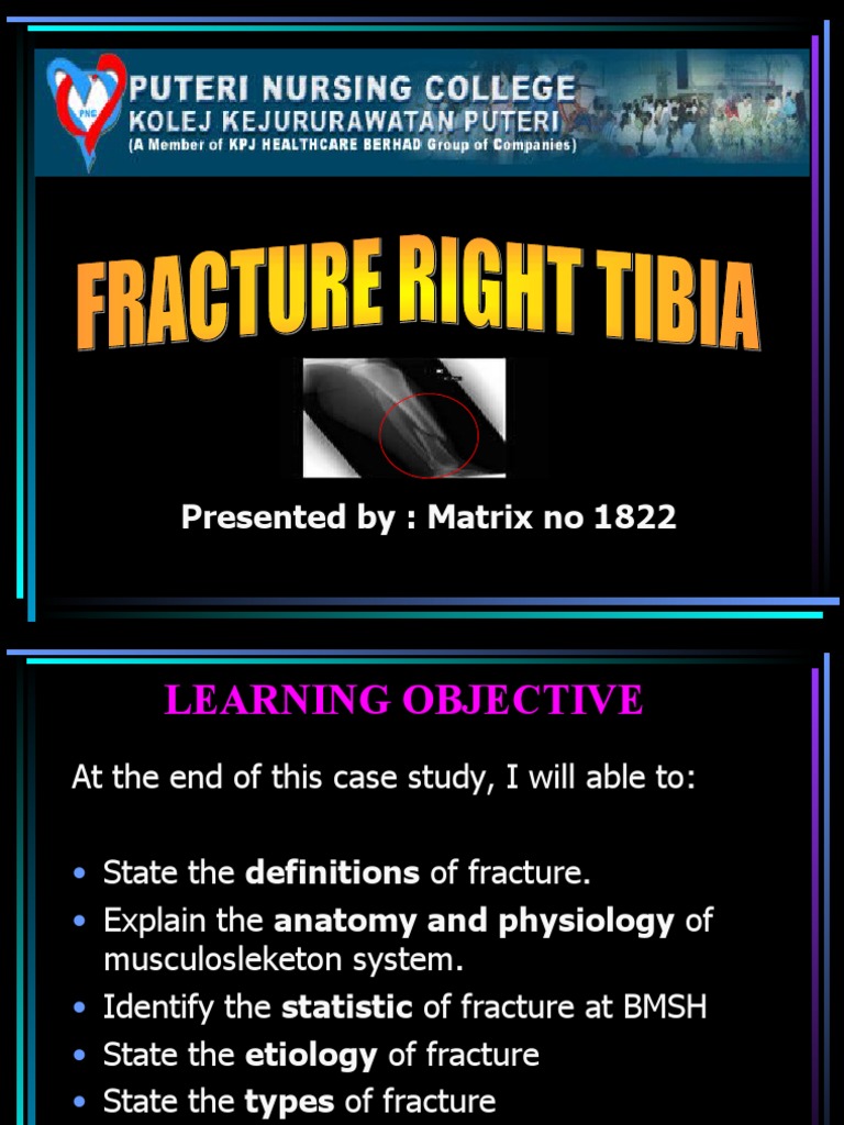# RT Tibia | Download Free PDF | Clinical Medicine | Medical Specialties