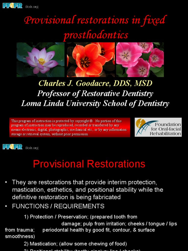 Provisional Restorations in Fixed Prosthodontics: Charles J. Goodacre ...