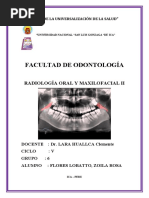 Tecnica de Waters | PDF | Cráneo | Cabeza y cuello humanos