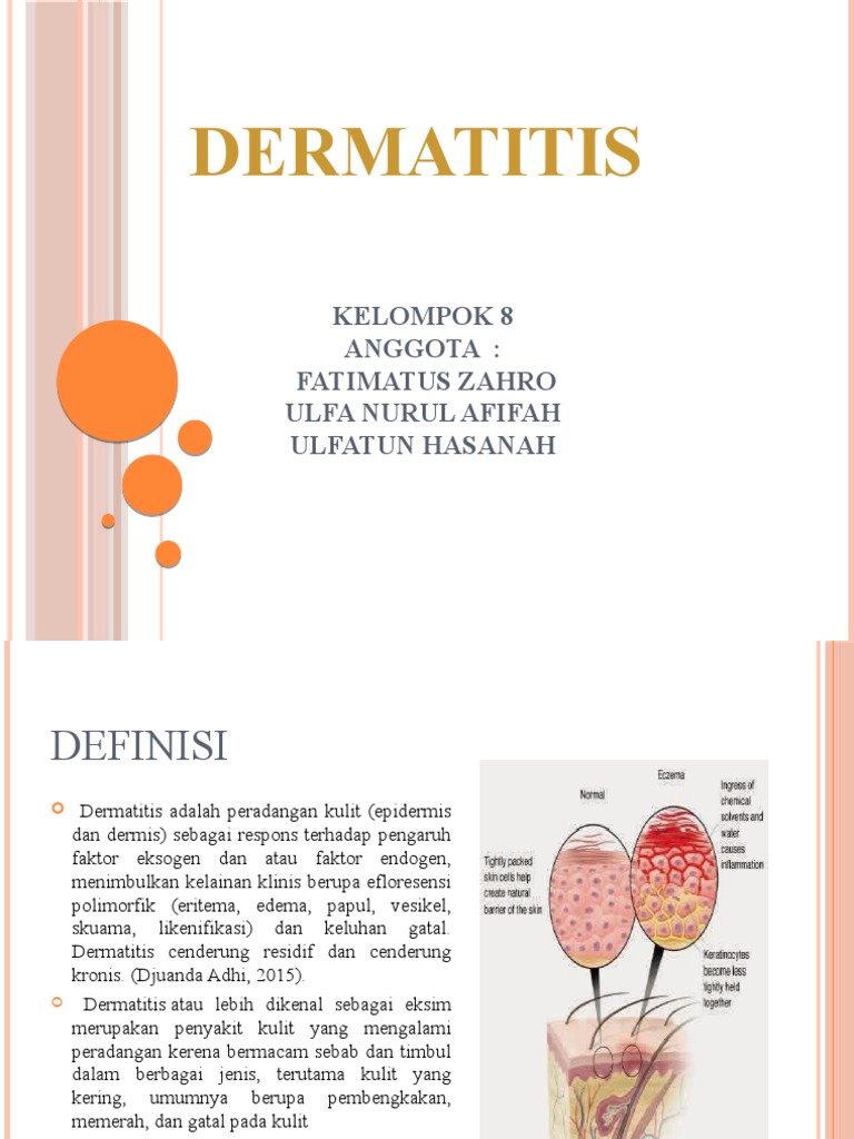 DERMATITIS PPT PPTX 1 | PDF