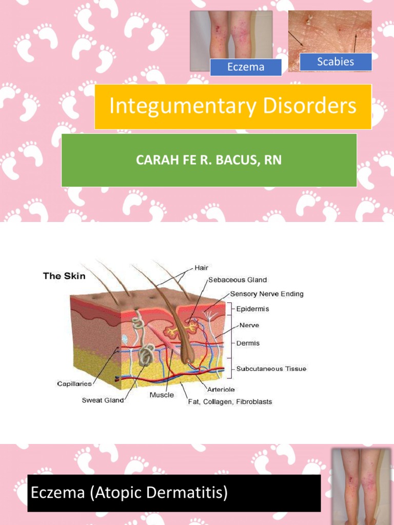 Integumentary Disorders (New) | PDF | Dermatitis | Burn