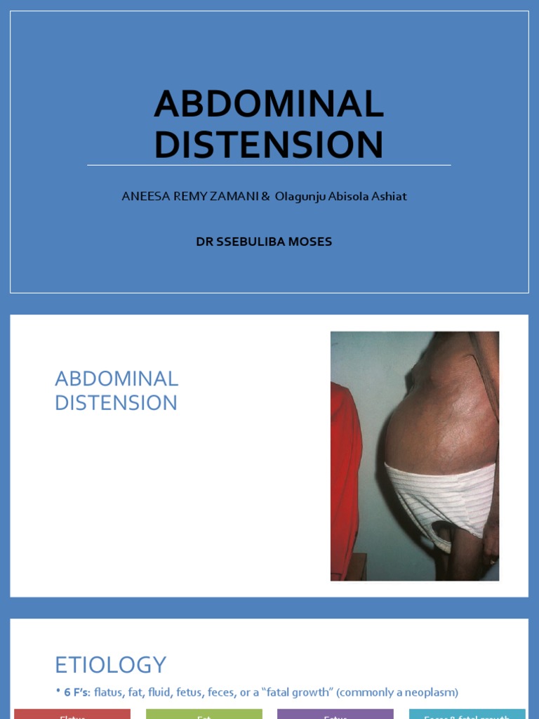 Abd Distension & Ascites-1, All New | PDF | Cirrhosis | Diseases And ...