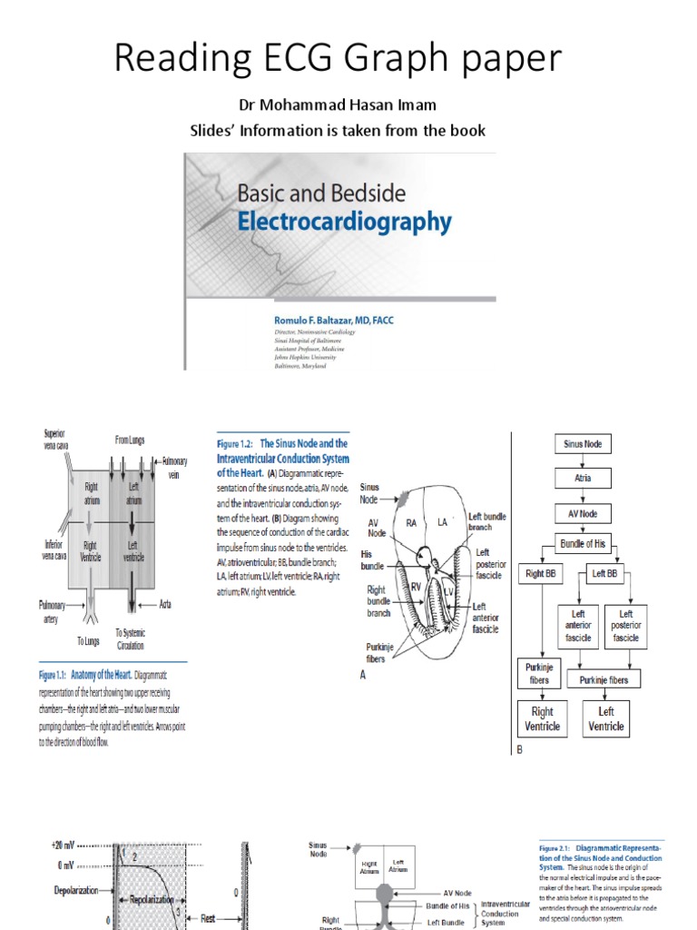 Understanding ECG Graph Paper | PDF