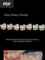 7 - Prótese Fixa - Inlays, Onlay e Overlay - Técnica de Preparo - 16.04 ...