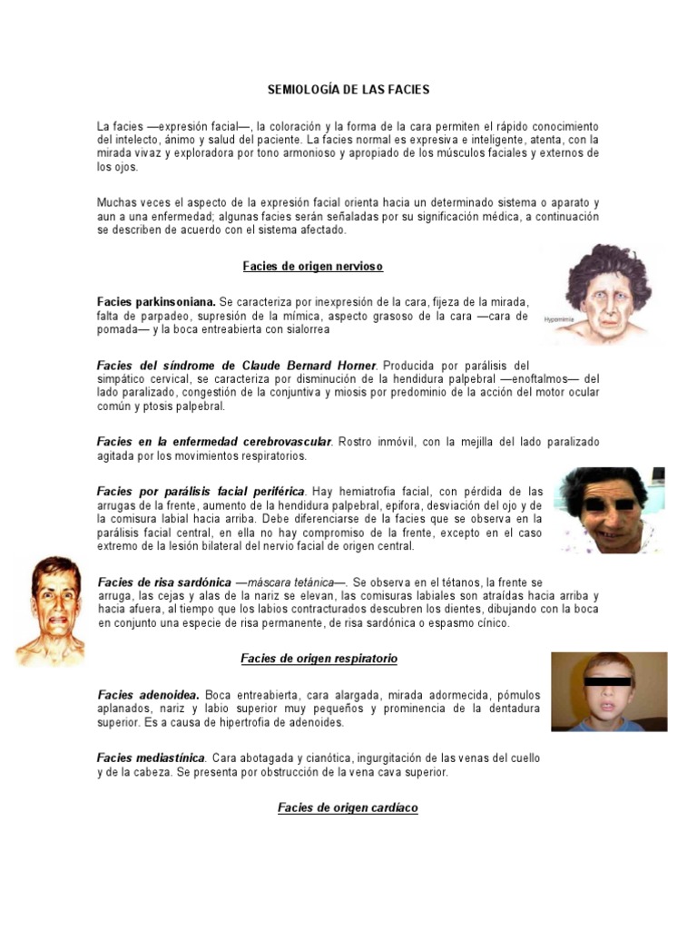 Facies De Semiologia | SEMIOLOGIA MÉDICA: Fácies Medicine-Me – IEYHQ