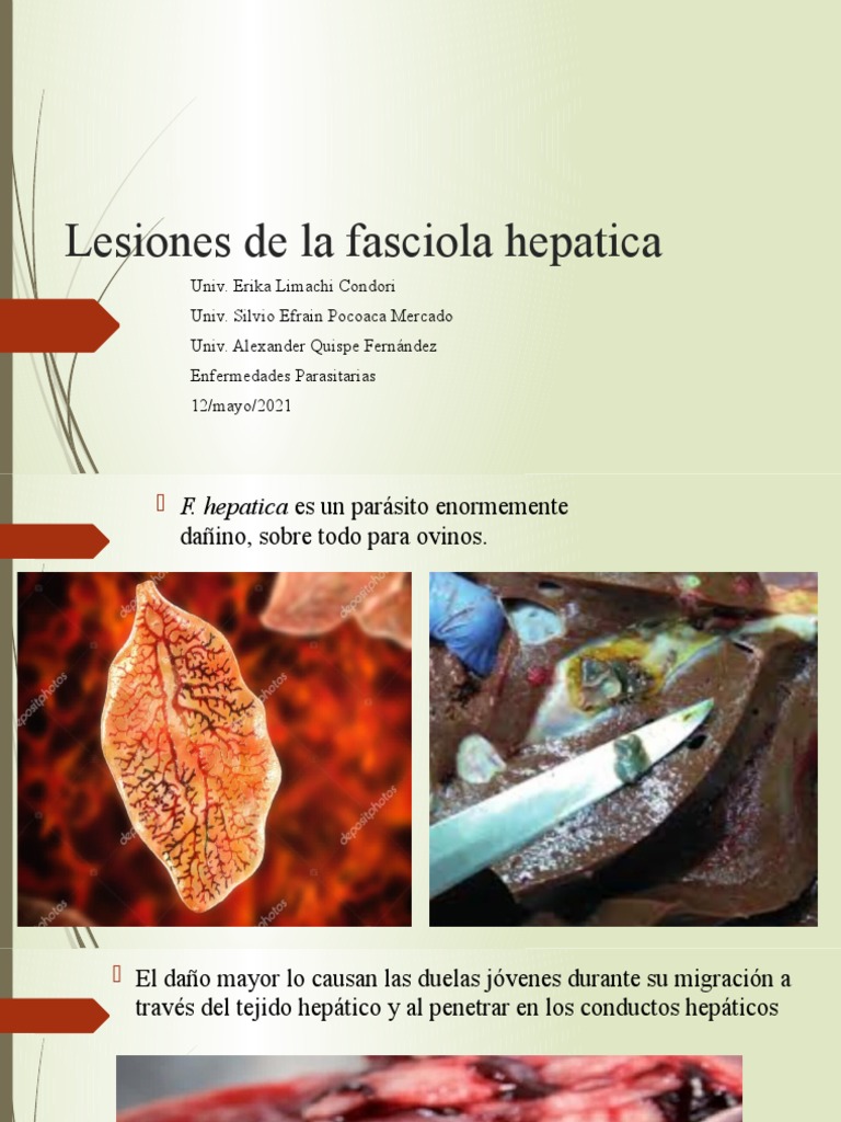 Las lesiones hepáticas causadas por la infección de Fasciola hepatica | PDF