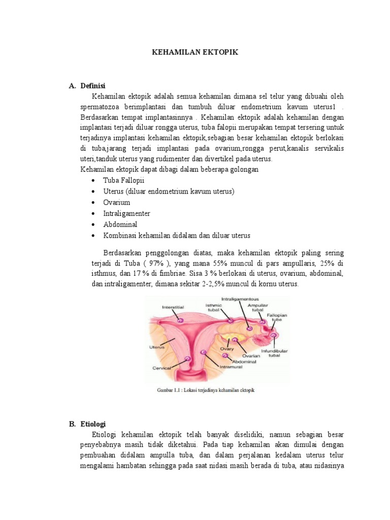 Panduan Lengkap Kehamilan Ektopik | PDF | Sains & Matematika