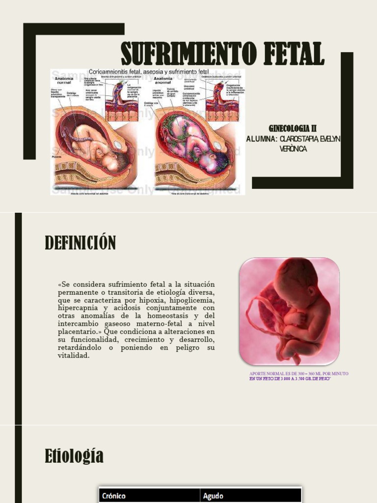 Sufrimiento Fetal Pdf El Embarazo Feto