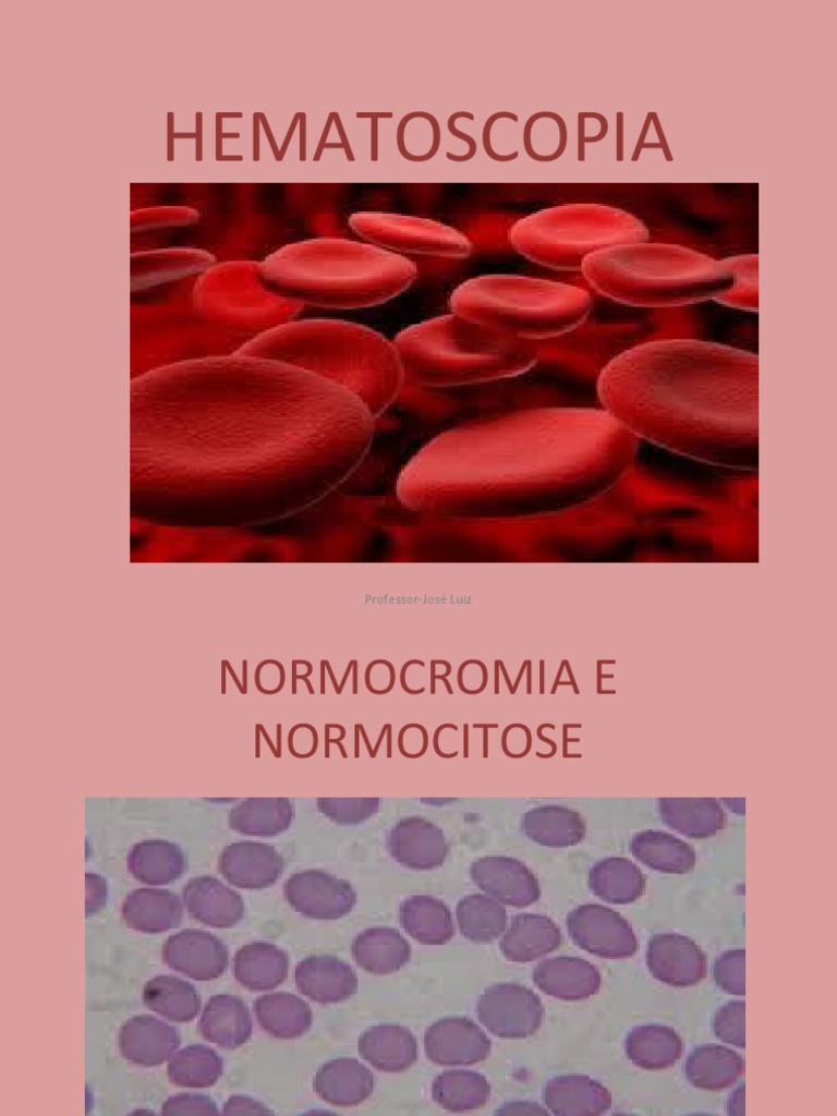 HEMATOS | PDF | Hemácia | Anemia