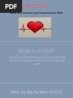 Ventricular Tachycardia - Monomorphic VT - LITFL | PDF ...