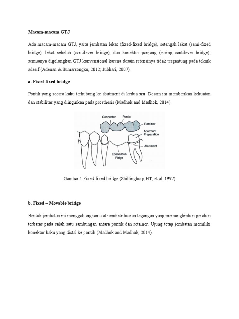 Macam-Macam Jembatan GTJ dalam Prosthodontik | PDF