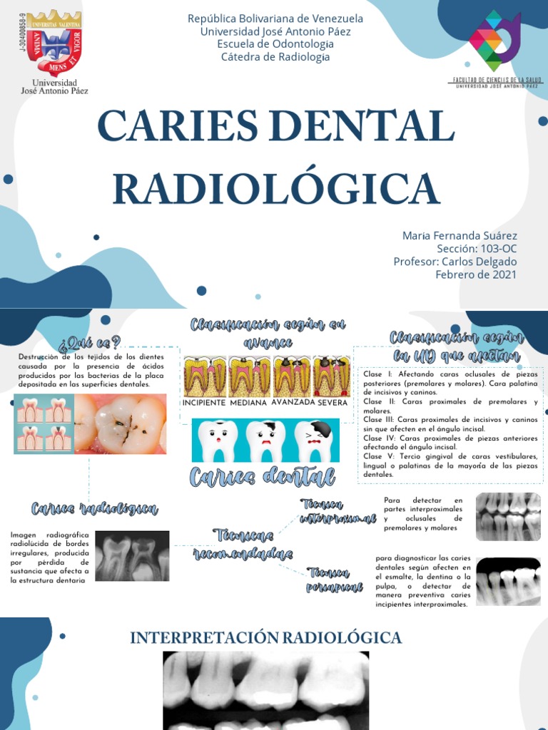Caries Dental Radiologica | PDF | Diente | Esmalte de dientes
