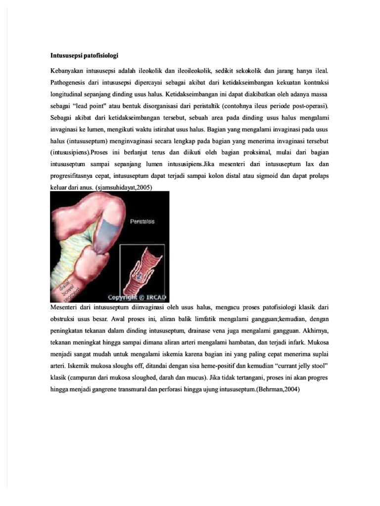 Intususepsi Patofisiologi | PDF