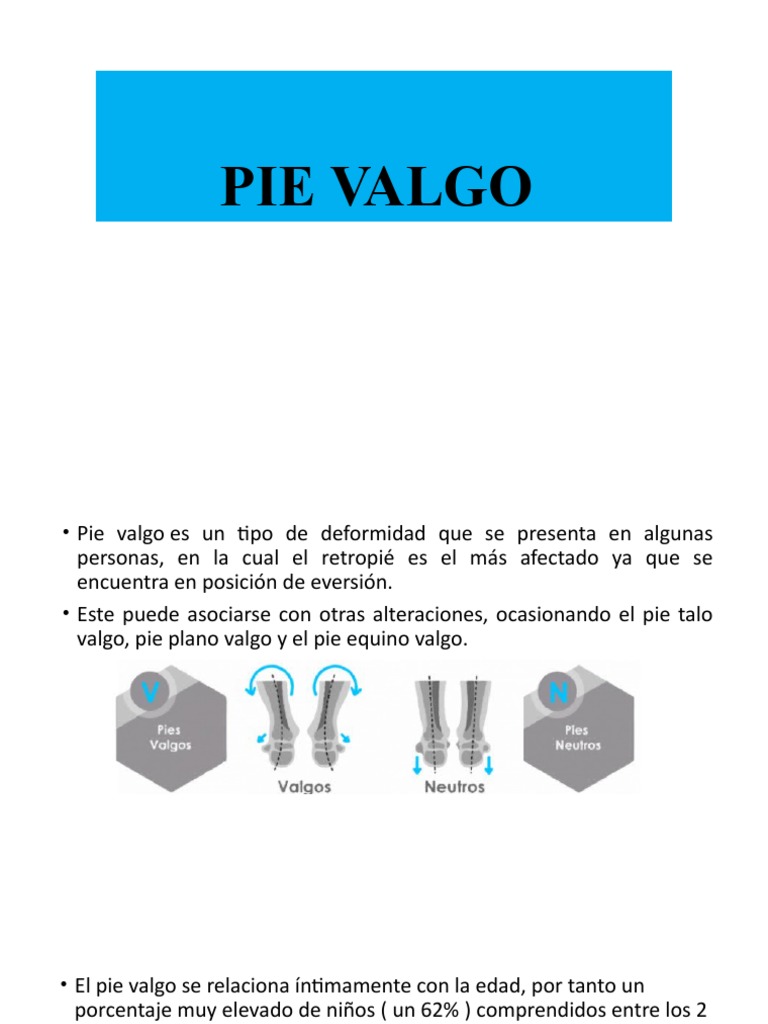 Pie Valgo | PDF