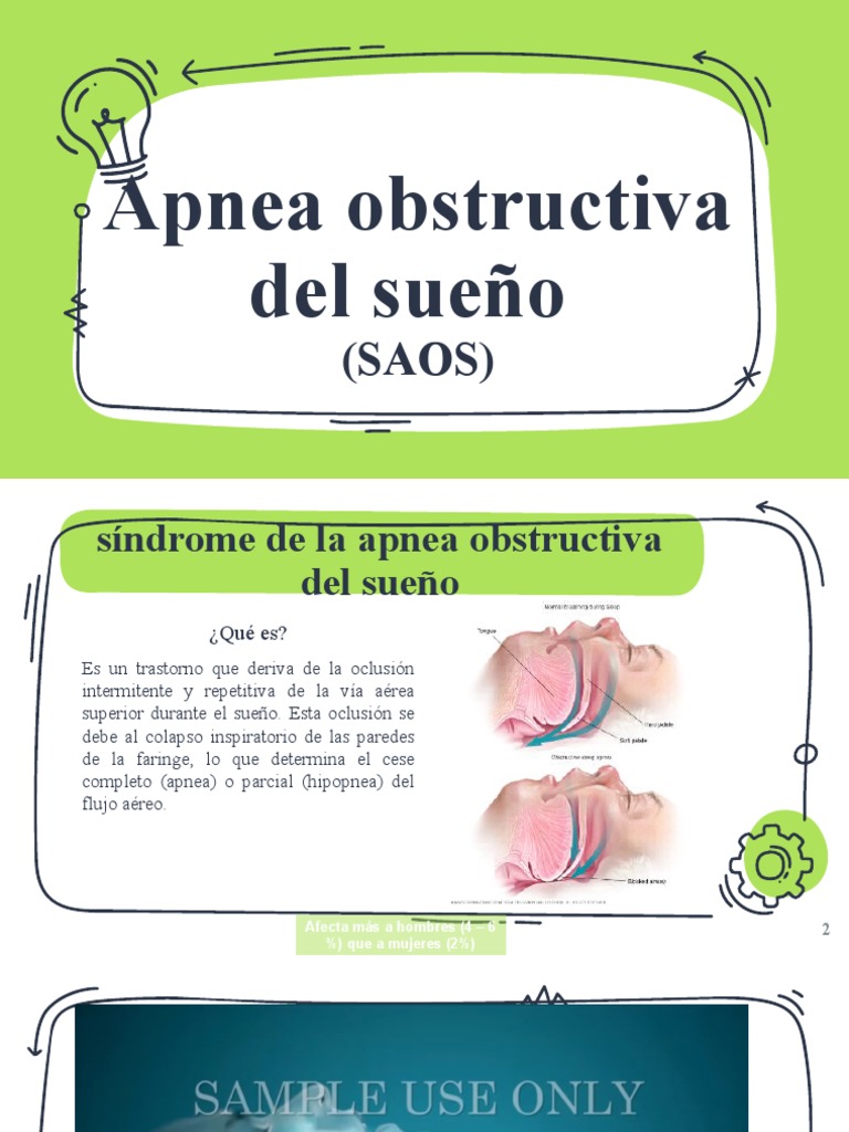 SAOS | PDF | Apnea del sueño | Medicina CLINICA