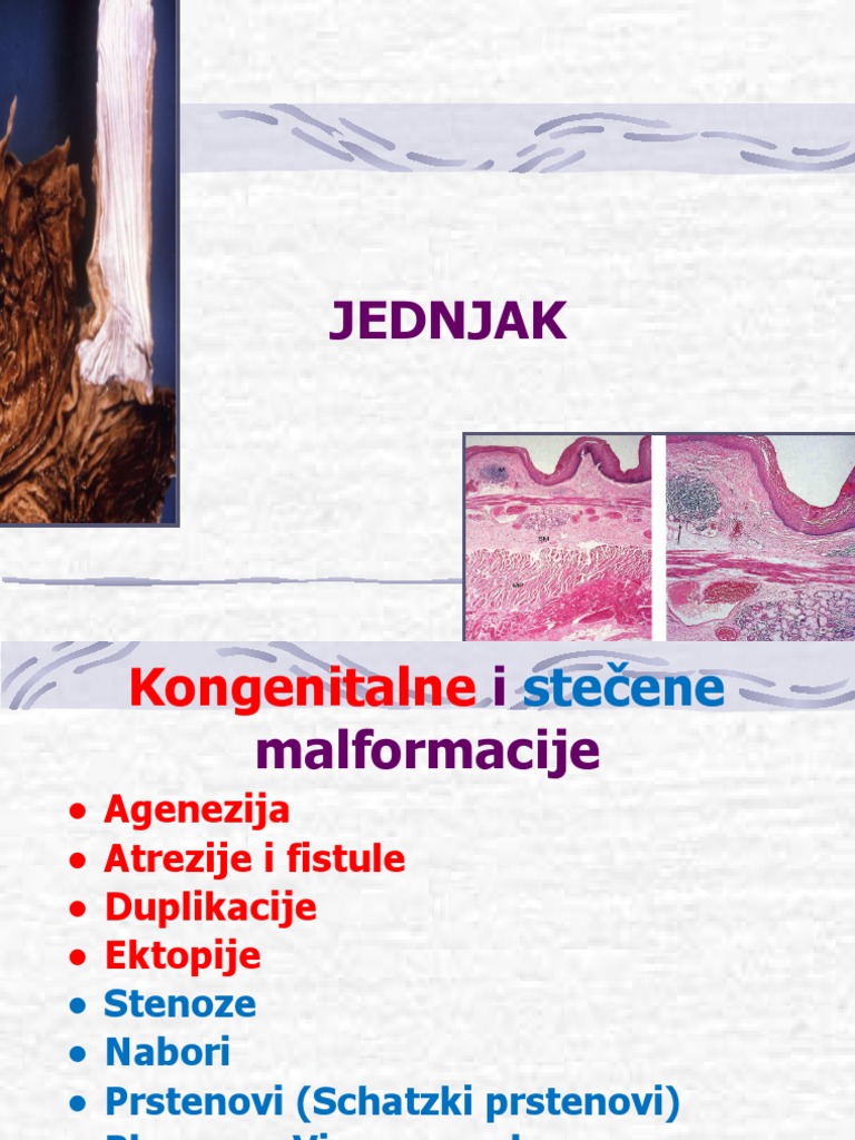 Jednjak 20 21 | PDF