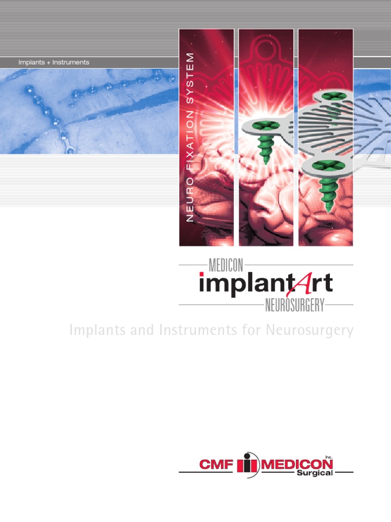 Brochure - Neuro Plating | Download Free PDF | Equipment | Manufactured ...