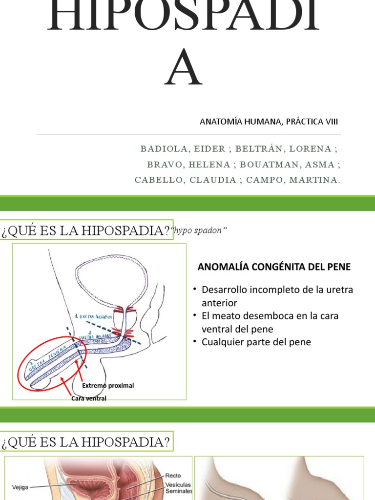 Hipospadia Final | PDF | Urología | Anatomia sexual