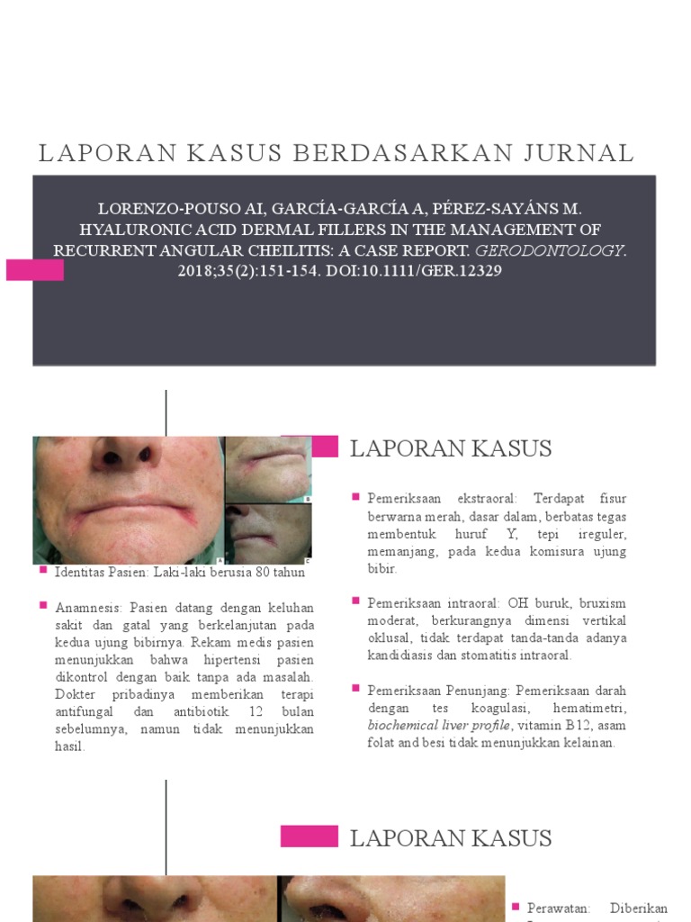 Angular Cheilitis | PDF