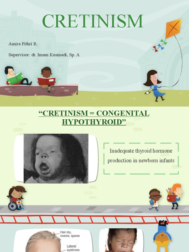 Cretinism: Amira Fithri R. Supervisor: Dr. Imam Kusmadi, Sp. A | PDF ...