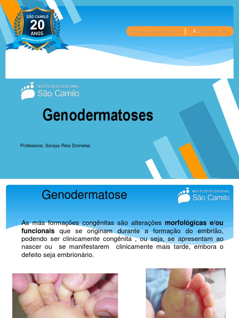 Genodermatoses: Características, Classificação e Abordagem das ...