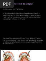 Extracción de Restos Radiculares | PDF | Boca | Odontología