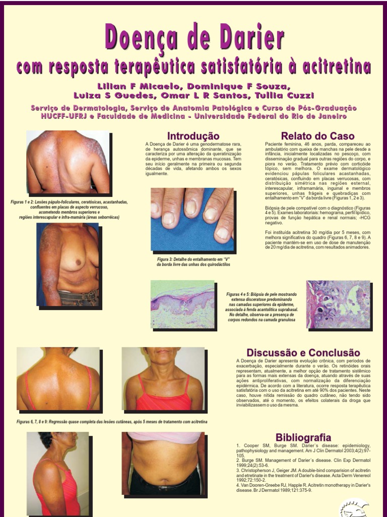 Doença de Darier | PDF | Pele | Especialidades médicas