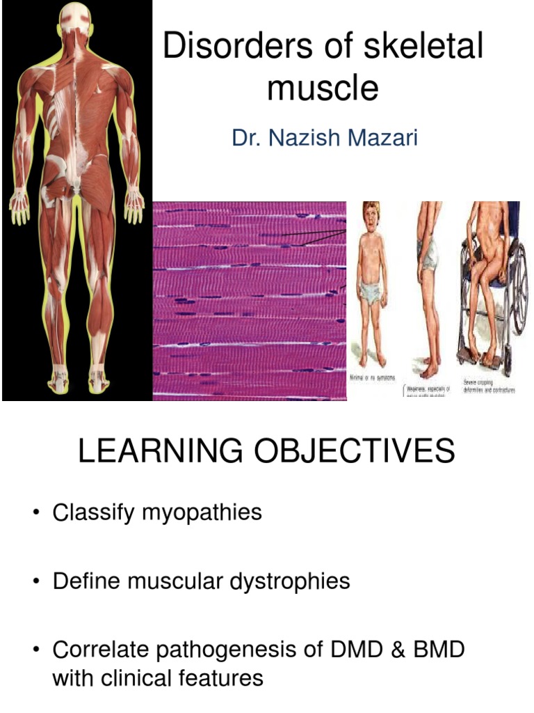 Skeletal Muscle Disorders Guide | PDF | Muscular Dystrophy | Weakness