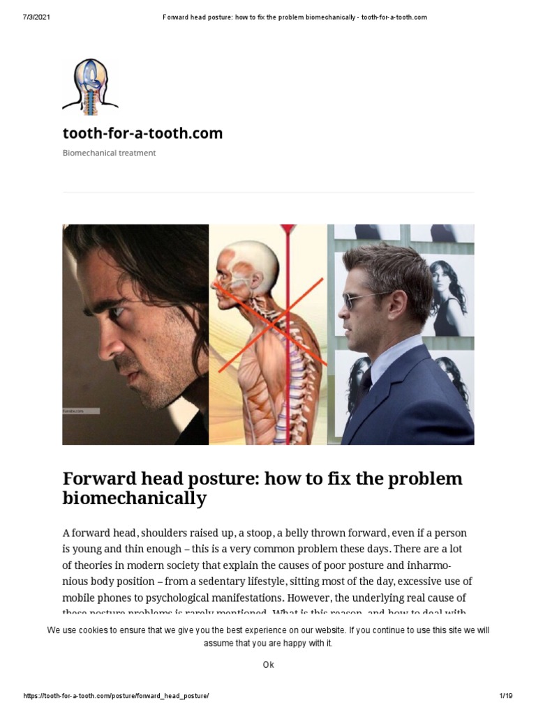 Forward Head Posture - How To Fix The Problem Biomechanically | PDF ...