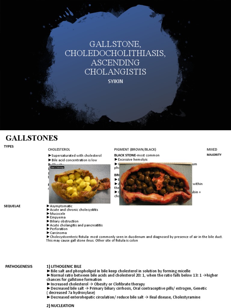 Gallstone, Choledocholithiasis, Ascending Cholangistis | PDF | Bile | Gallbladder