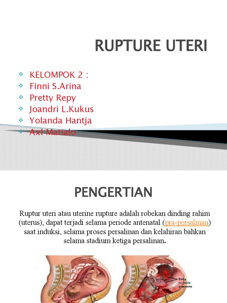 Rupture Uteri | PDF