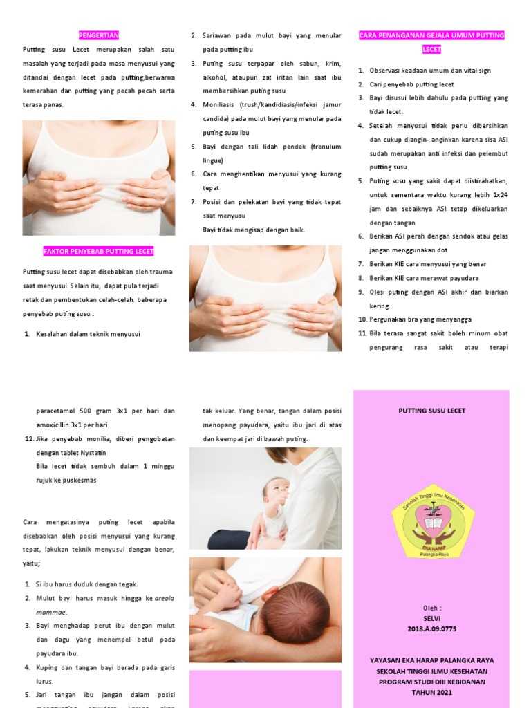 Selvi - Leaflet Puting Susu Lecet | PDF