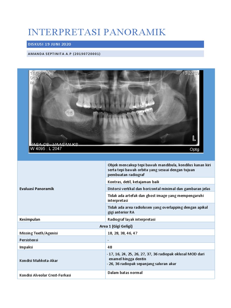 AMANDA S (20190720001) - Interpretasi Panoramik | PDF