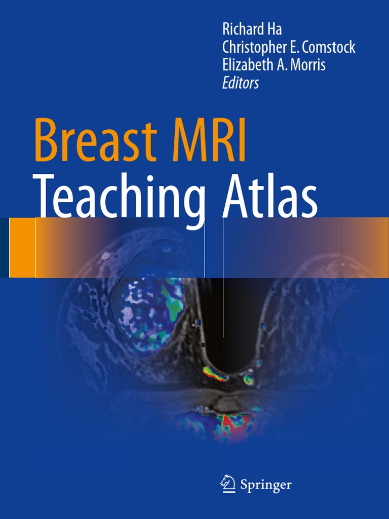 Breast MRI | PDF | Magnetic Resonance Imaging | Radiology