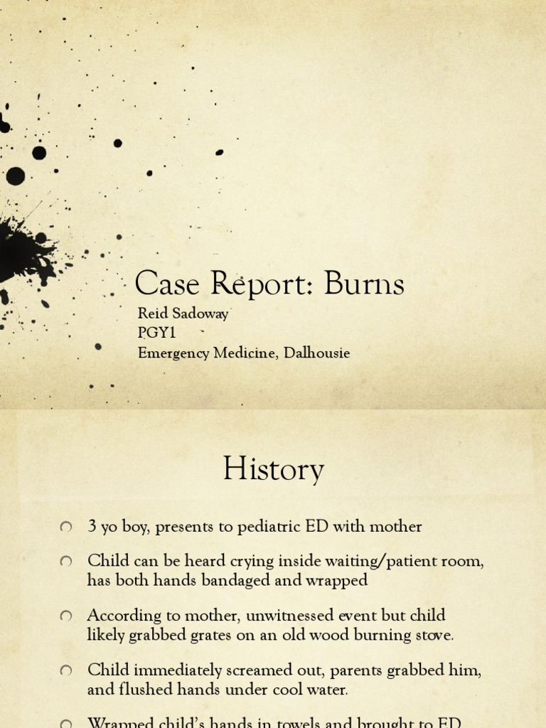 Case Report: Burns: Reid Sadoway Pgy1 Emergency Medicine, Dalhousie ...