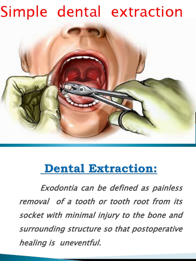 Sem 7 OMFS1 20-4-2020-Forceps Extraction | PDF | Tooth | Dentistry