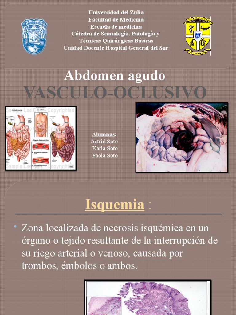 Abdomen Agudo Vasculo Oclusivo | PDF | Isquemia | Trombo