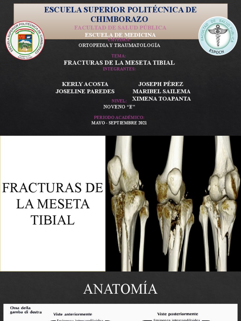 Grupo 2 - Meseta Tibial | PDF | Rodilla | Sistema musculoesquelético