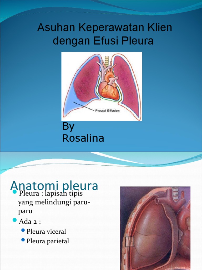 Askep Efusi Pleura | PDF