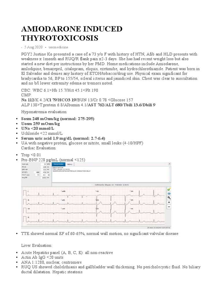 Amiodarone Induced Thyrotoxicosis: Na 112/K 4.2/Cl 79/HCO3 19/BUN 13/Cr ...