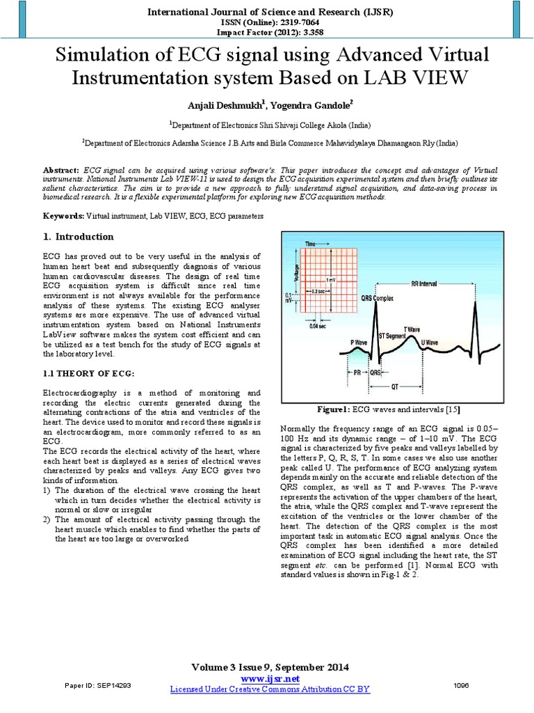 Simulation of ECG Instrumentation ECG Signal Using Advanced ...